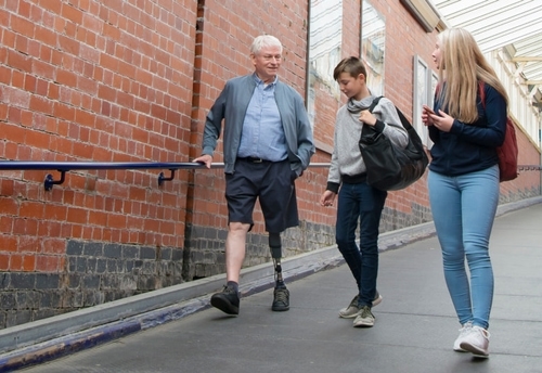 Prosthetic Arm: Function, Types, Cost