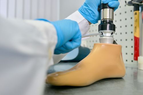 What Are The Different Types of Prosthetics?
