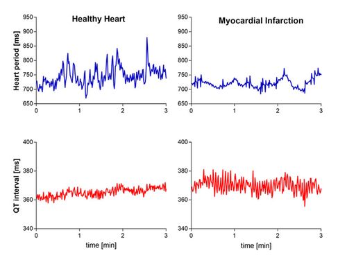 Heart Rate Variability Fluctuates by Age, Gender, Activity and Time of ...