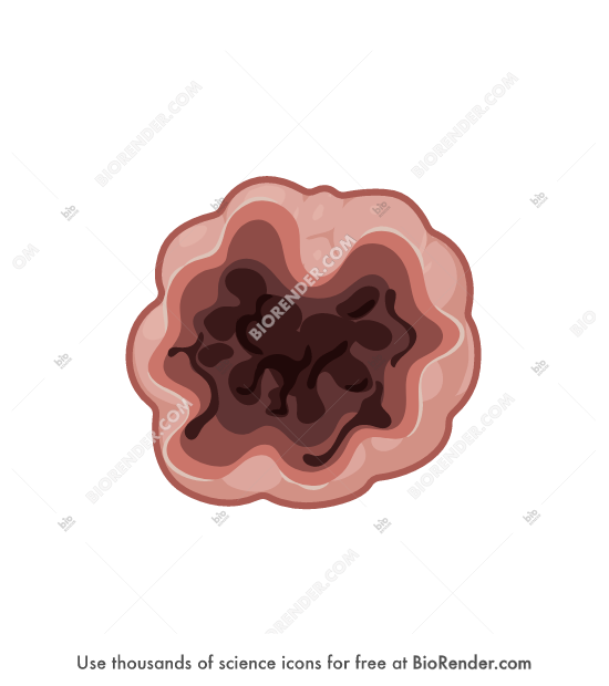 Free Tumor (round, necrosis 2) Icons, Symbols & Images | BioRender