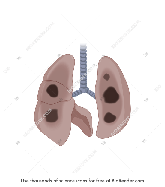Free Mouse lungs (diseased) Icons, Symbols & Images | BioRender