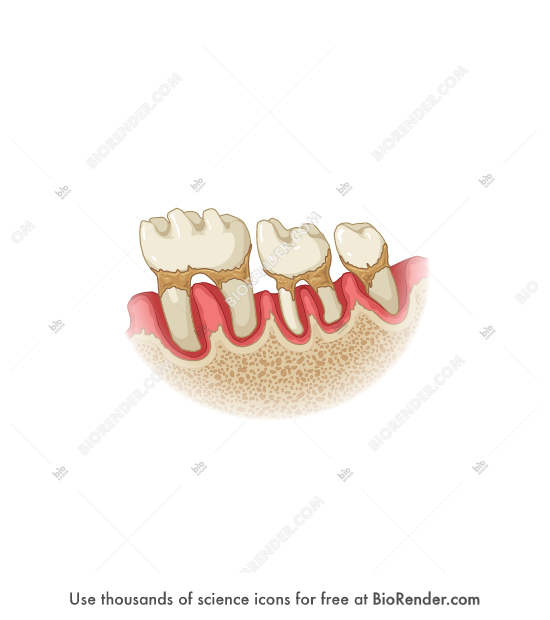Free Mouse teeth (molars, gums, peridontitis) Icons, Symbols & Images ...