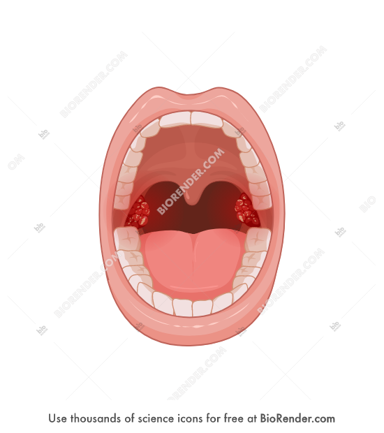 Free Mouth (open, tonsillitis) Icons, Symbols & Images | BioRender