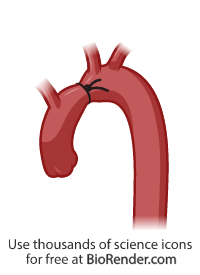 Free Transverse aortic constriction (TAC, mouse) Icons, Symbols ...