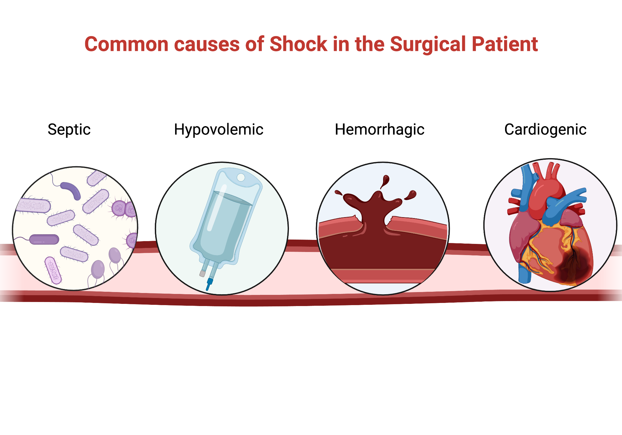 Causes of shock | BioRender Science Templates