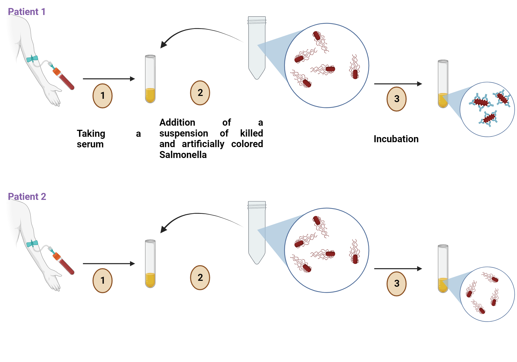 Detection of Salmonella infection by agglutination test | BioRender ...