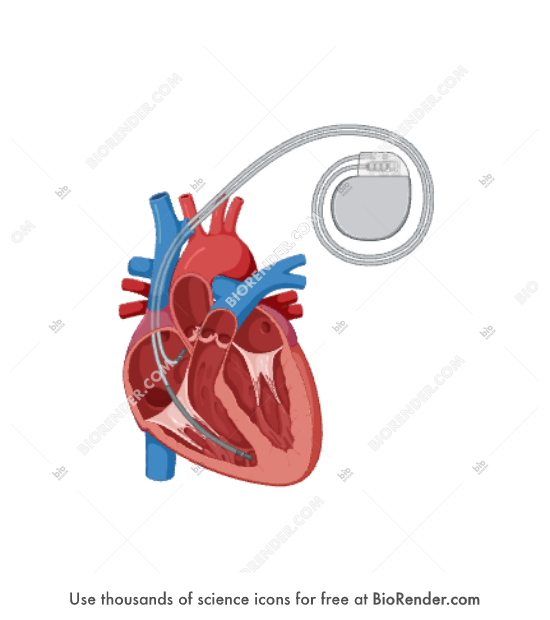 Free Heart cross-section with ICD Icons, Symbols & Images | BioRender