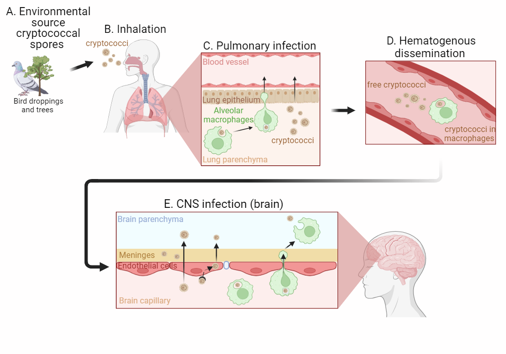 Pathogenesis of Cryptococcus Infection: From Inhalation to CNS ...