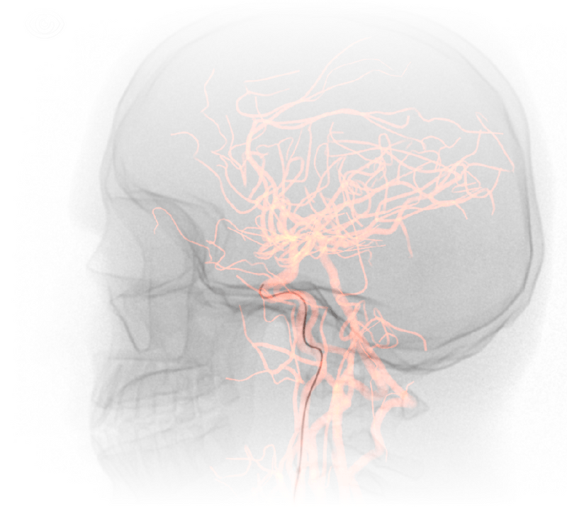 Medical Simulators for Interventional Procedures