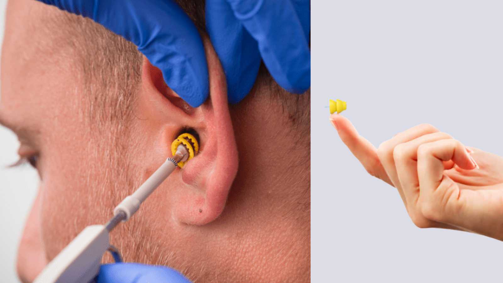 An Audiologist's Review Lyric Hearing Aids
