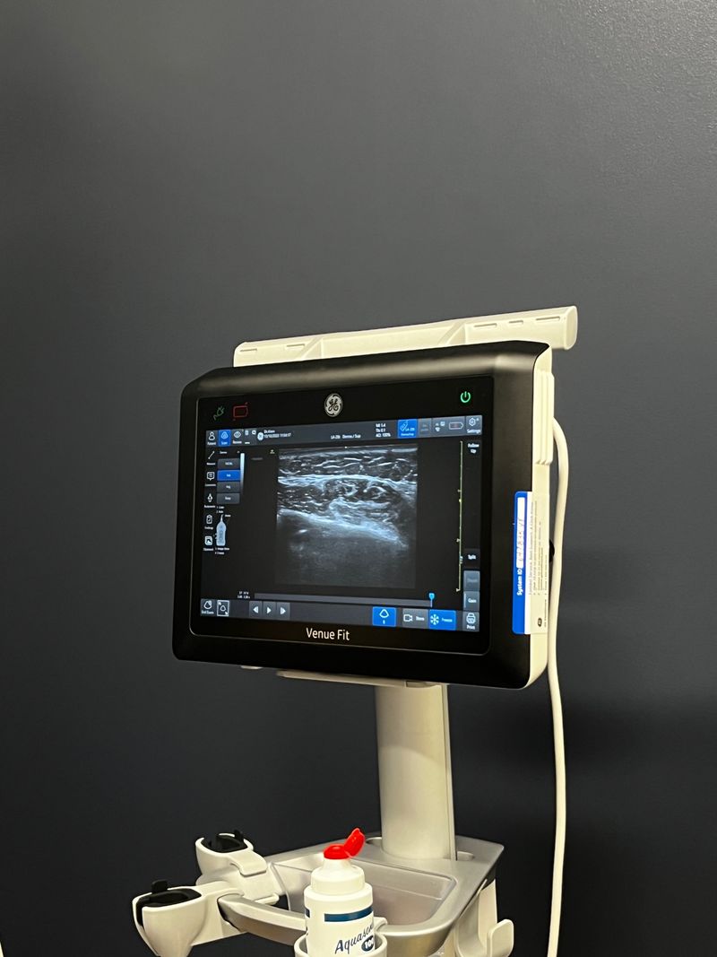 Ultrasound Guided Fillers Toronto