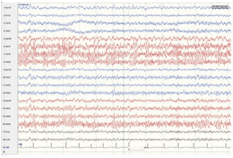 EEG Fun Facts | New Every Friday | Neuro Pathway