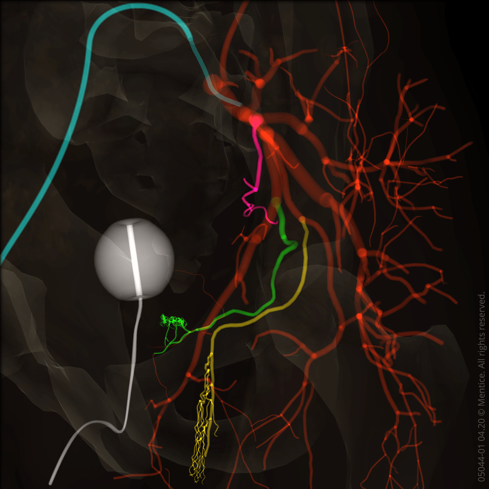 Virtual Reality endovascular simulators