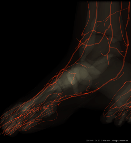 Virtual Reality endovascular simulators