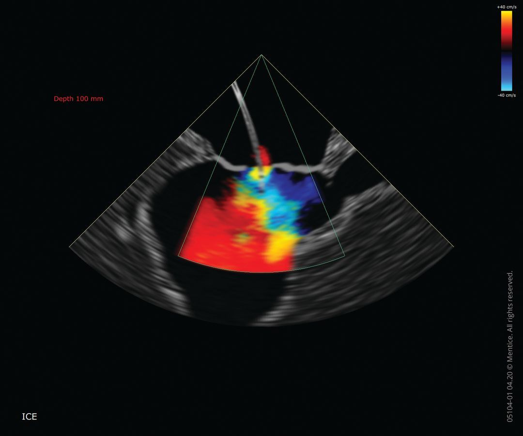 VIST® G7 and G7+ | Simulators | Mentice