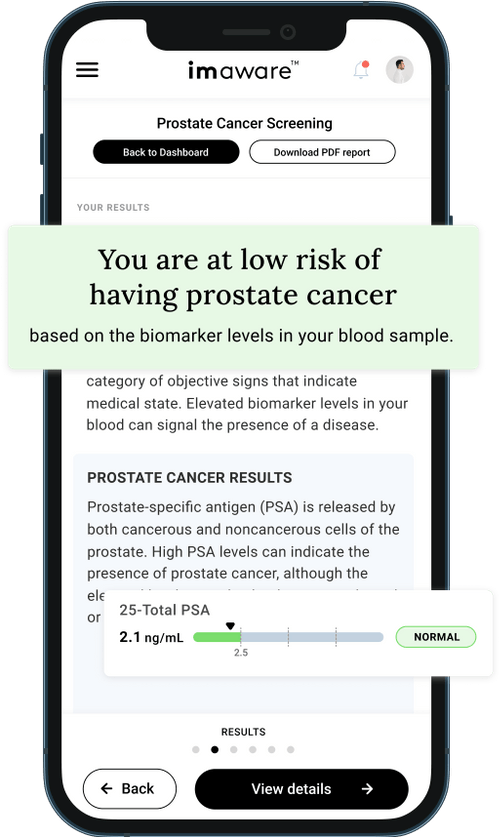 At Home PSA Prostate Cancer Test Kit | Fast Results $89 | imaware