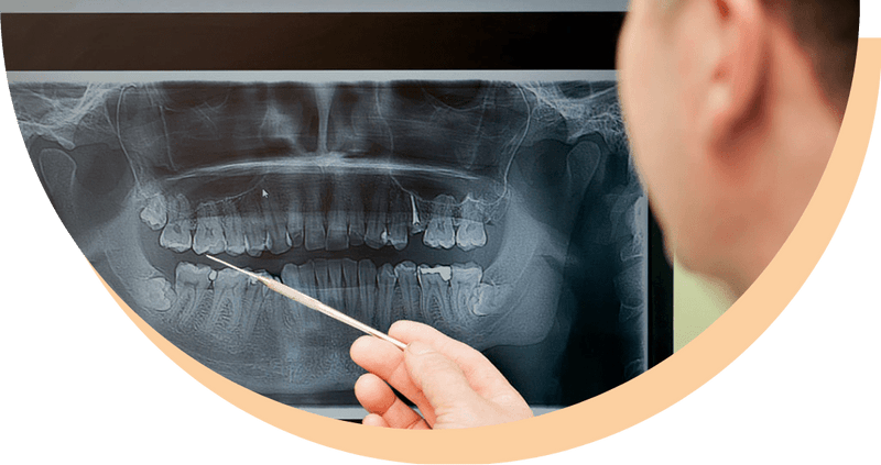 Transforming Smiles: Visit Our Fairfield Oral Surgery Office