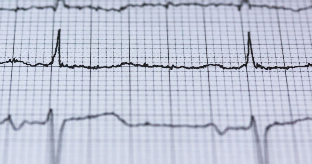 Prompt Injection Attack on GPT-4 — Robust Intelligence