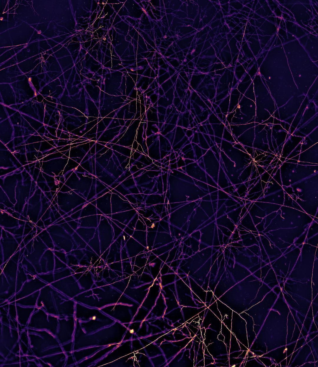 Mycorrhizal Fungi Explainer and Definition