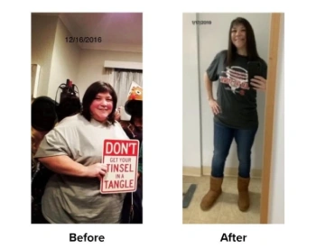 Late Complications of Bariatric Surgery: Symptoms to Watch For | BASS ...