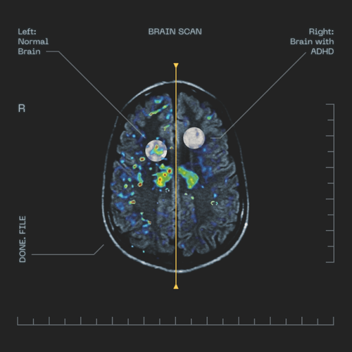 Done ADHD Online Care