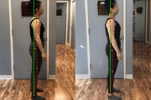 Top NYC Chiropractor - Body In Balance Chiropractic Midtown