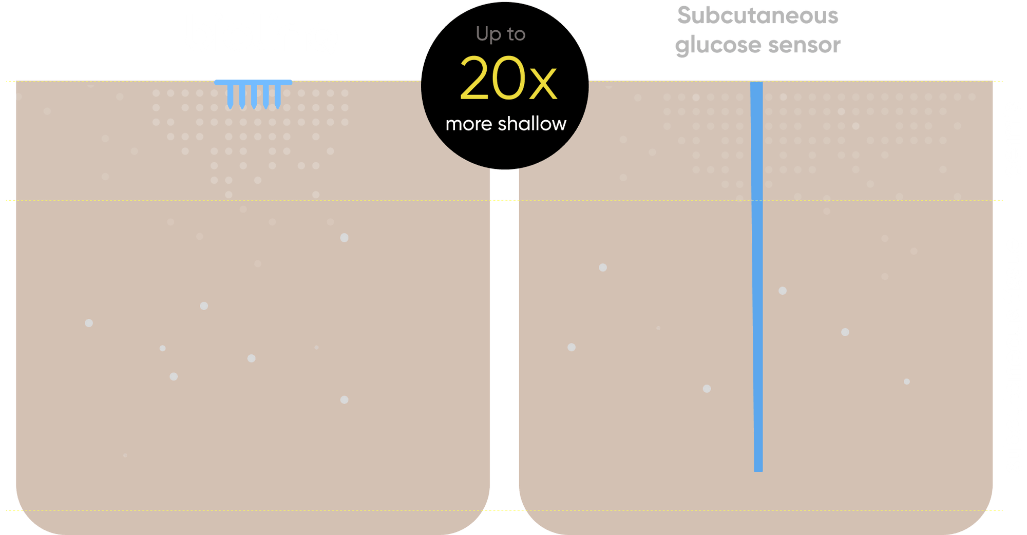 Biolinq | Wearable Biosensors