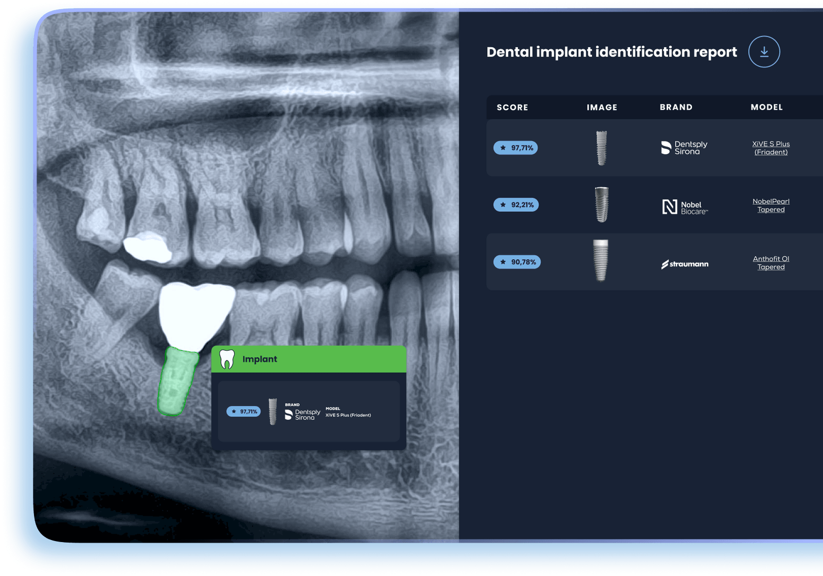 Spotimplant by Allisone Identification of unknown implants within 24 hours