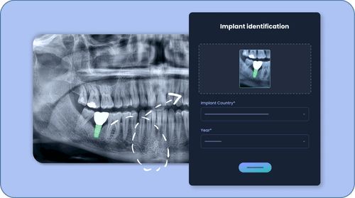 Spotimplant by Allisone Identification of unknown implants within 24 hours