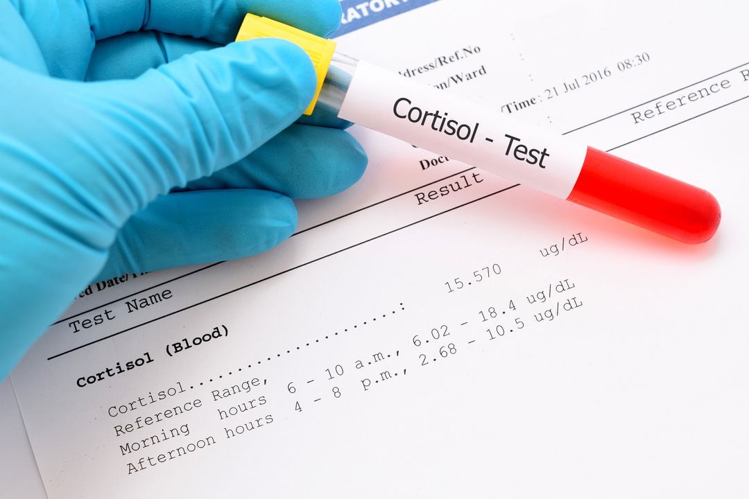 Cortisol Testing | Test Your Cortisol Levels (Blood, Urine, Saliva)