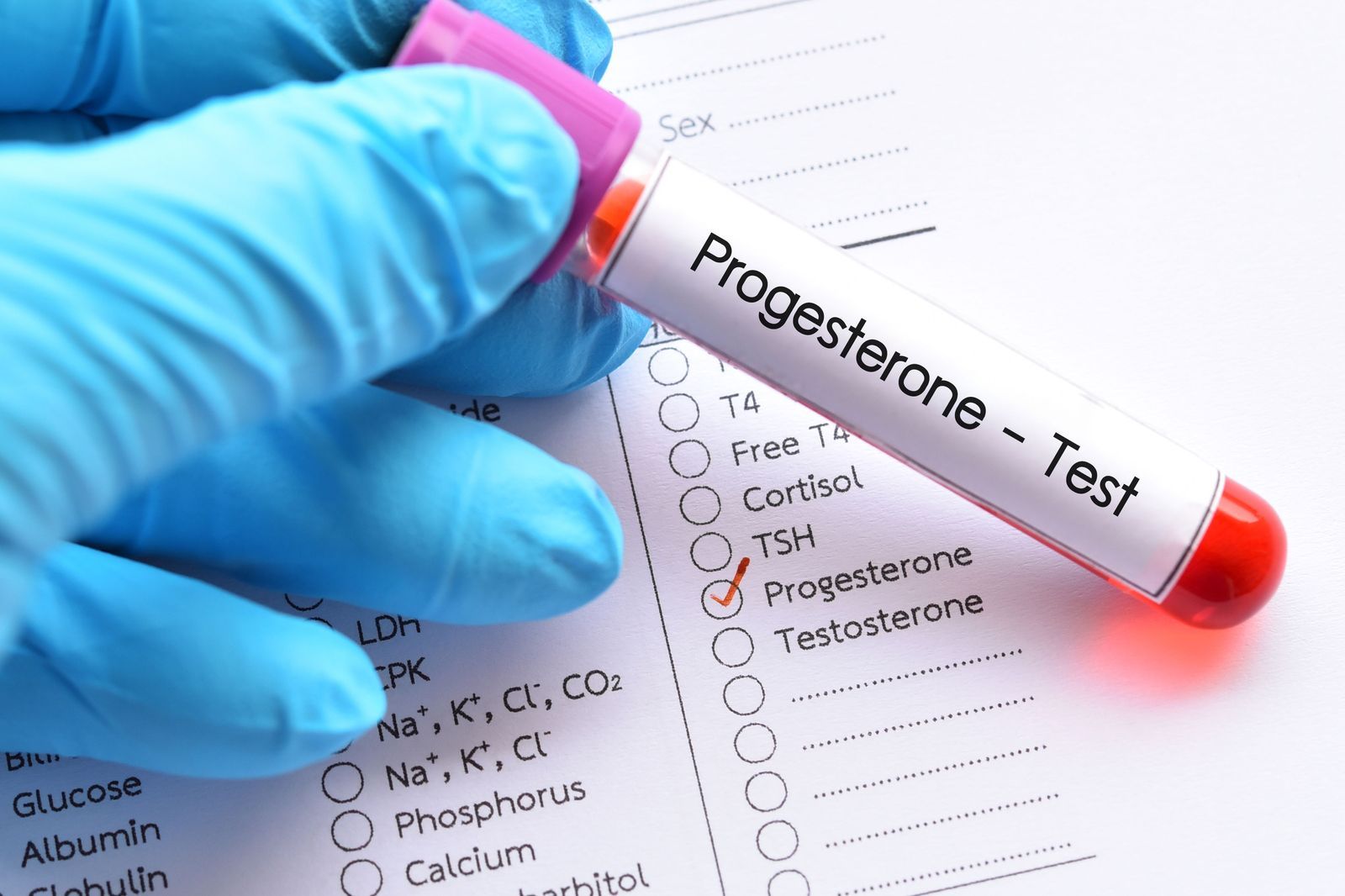 Progesterone Testing | Test Your Progesterone Levels