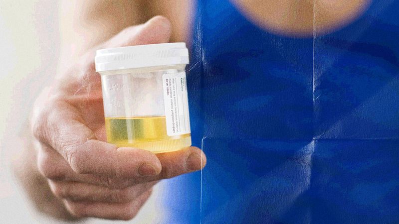 What Can Cause a False Positive Drug Test For Suboxone? | Ophelia