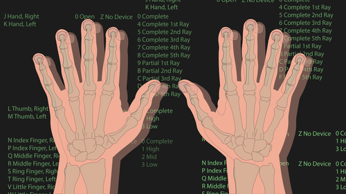 Coverself | ICD-10-PCS Coding for Hand and Foot Amputations