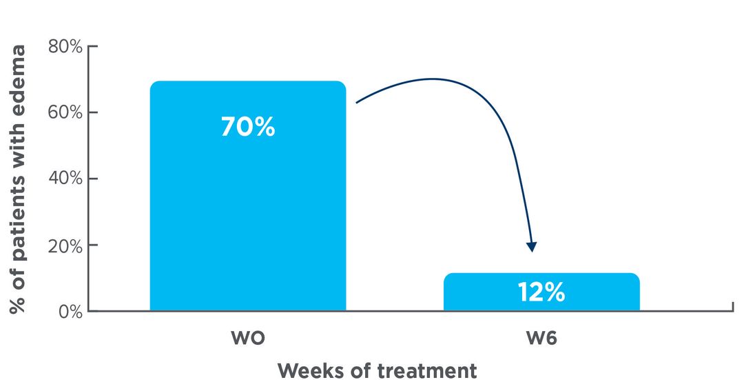 UrgoK2 - Dual Compression System
