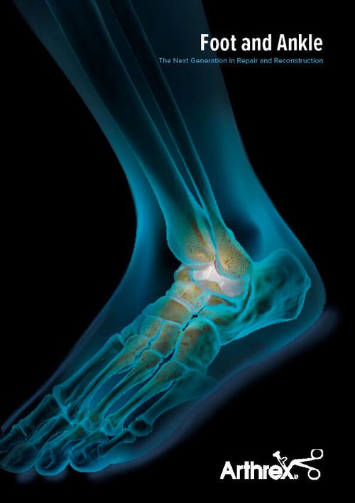 Your Specialist for Medical Technology | Arthrex UK