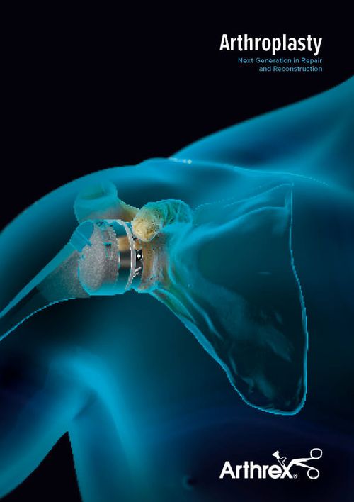 Your Specialist for Medical Technology | Arthrex UK