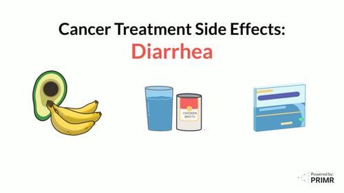 PRIMR | Prostate Cancer Radiation Simulation Procedure - Patient ...