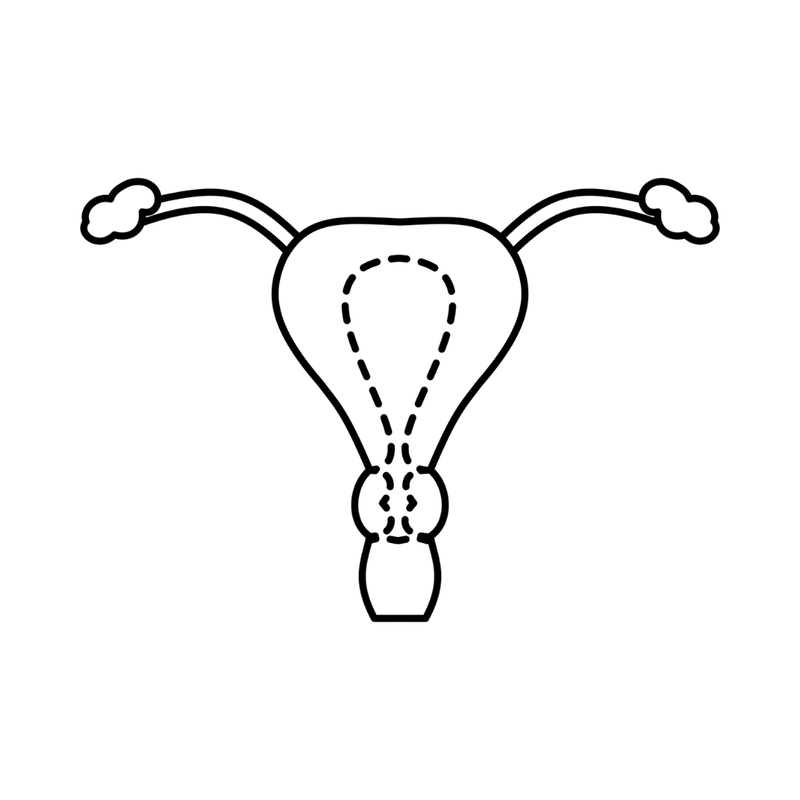 PRIMR | Decipher Prostate Genomic Test - Patient Video