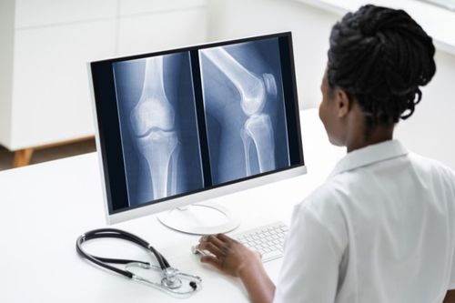 From X-Rays to CT Scans: Understanding Your Radiation Exposure