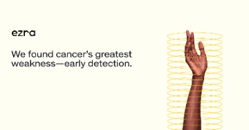 Full-body MRI Scan | Radnet | Ezra