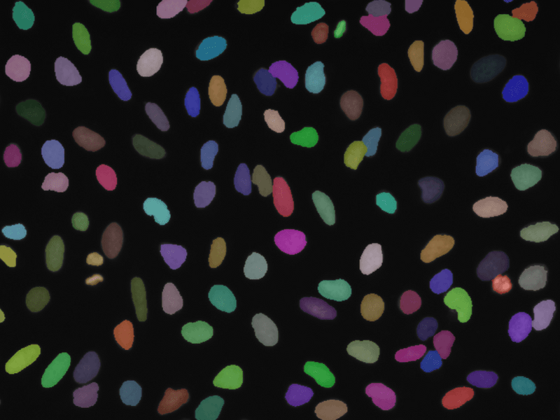 How to train YOLOv8 segmentation on a custom dataset