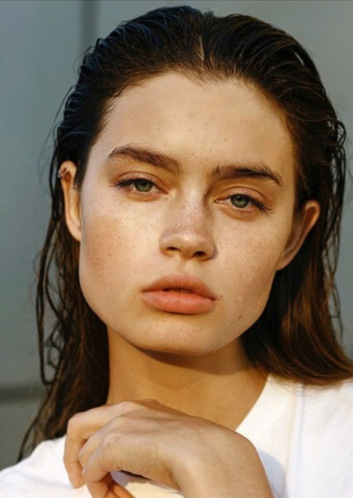 Transforming Your Jawline: Botox for Your Masseter Muscle