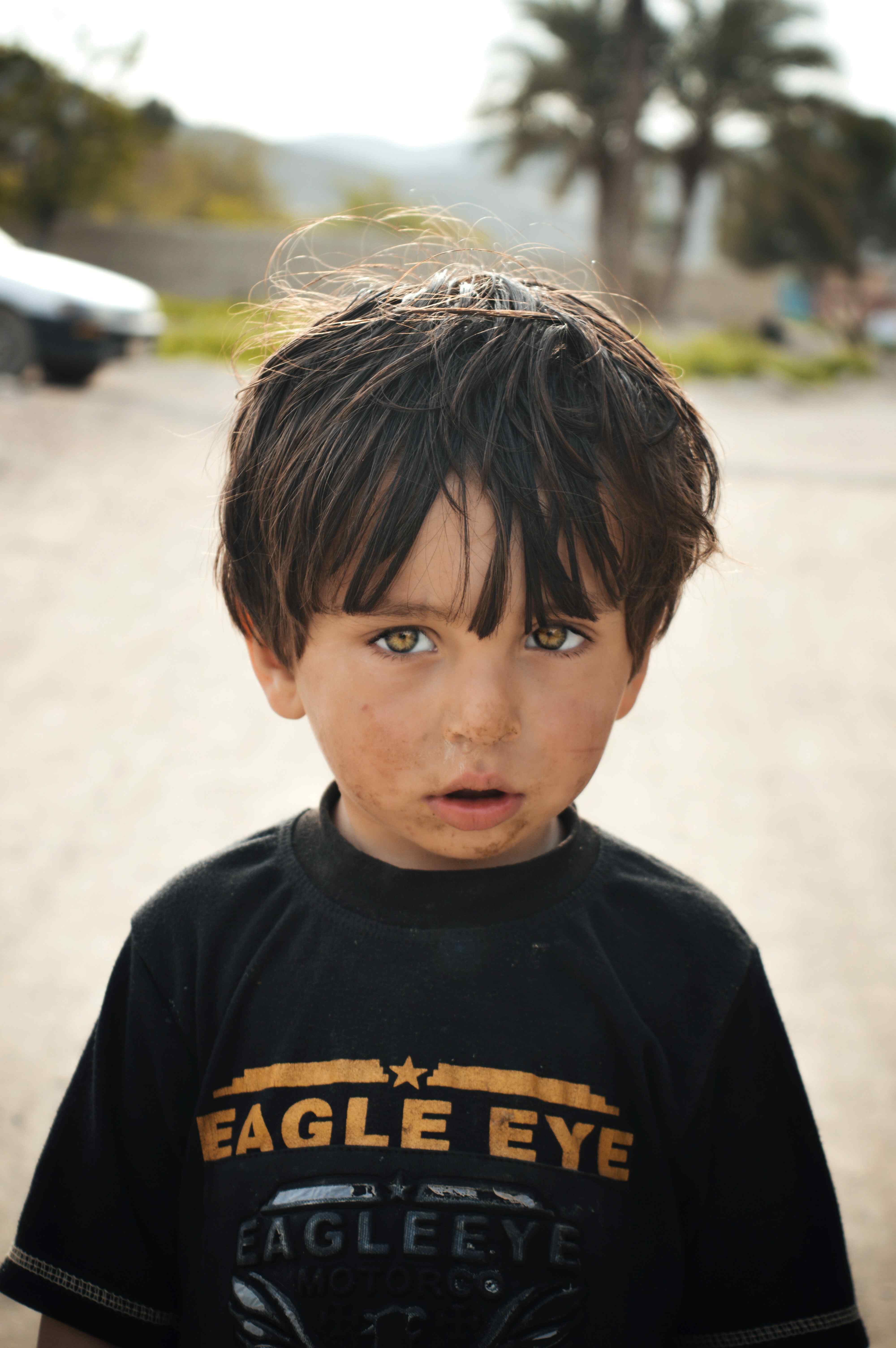 Toddler Blinking A Lot And Autism Explored