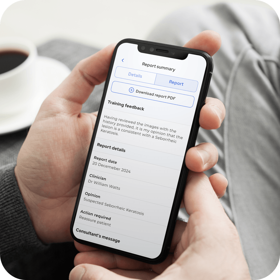 Mole Checks For Clinics