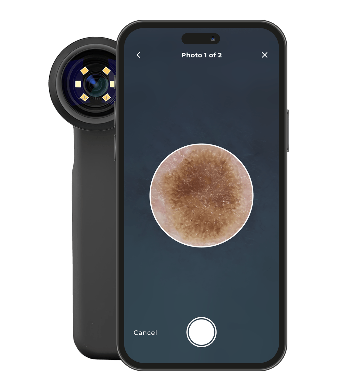 Mole Checks For Clinics