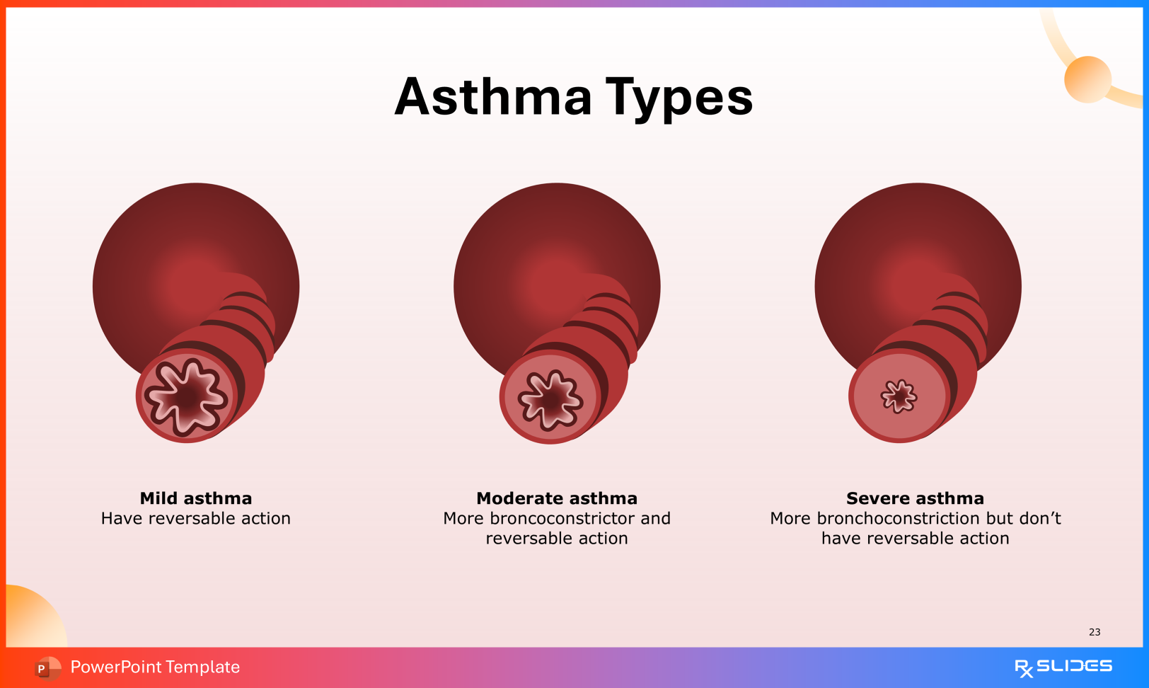 How to Use an Asthma PowerPoint Template for Medical Education and ...