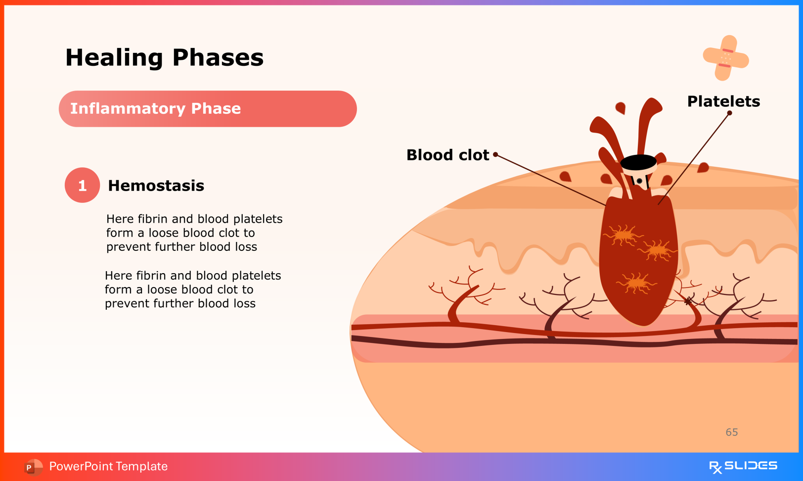 A Guide to Presenting Wound Management in PowerPoint - Market - Webflow ...