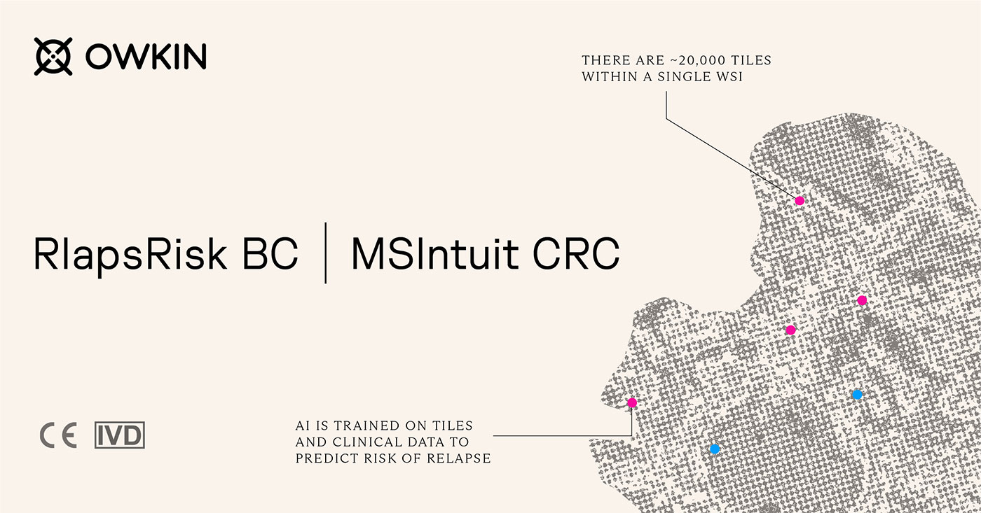 Two first-in-class AI diagnostic solutions for breast cancer and colorectal cancer developed by ...