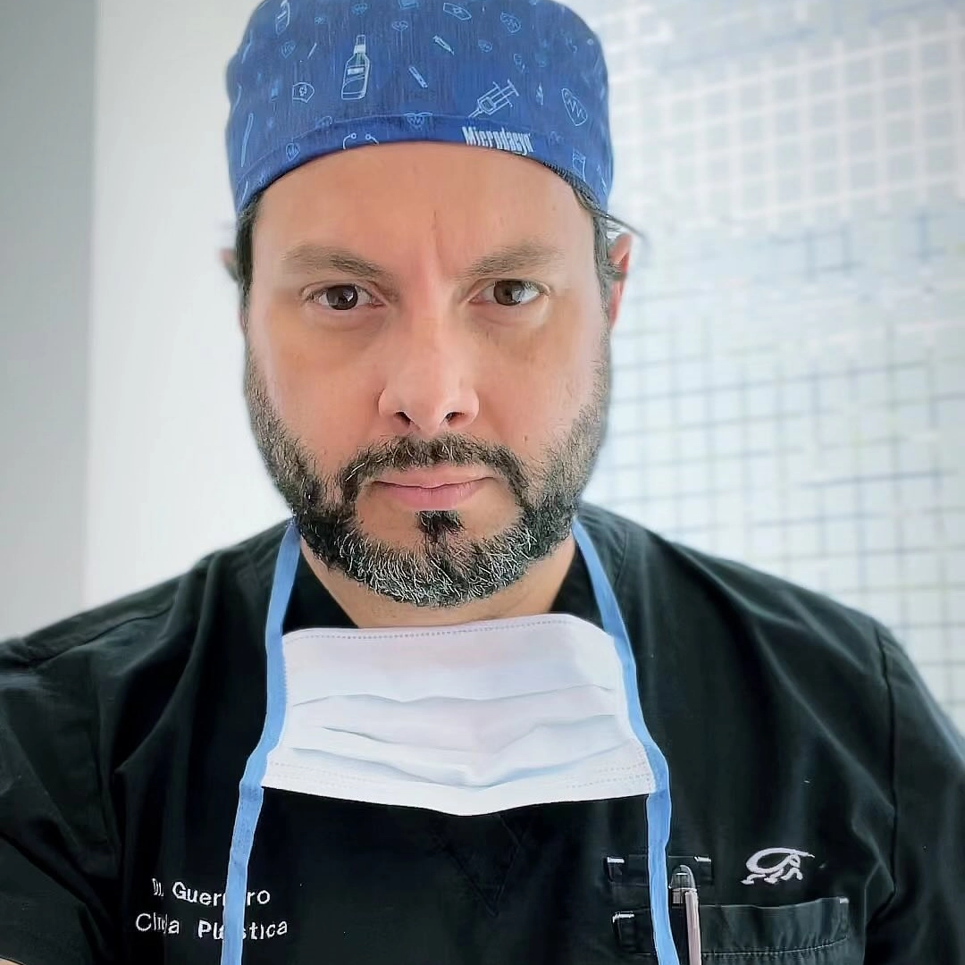 Lipoabdominoplastia | Dr. Fernando Iván Guerrero Burgos