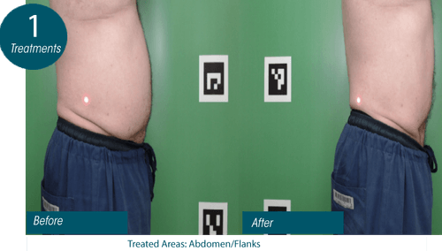 CellSound Aesthetics® | Anti-Aging & Contouring